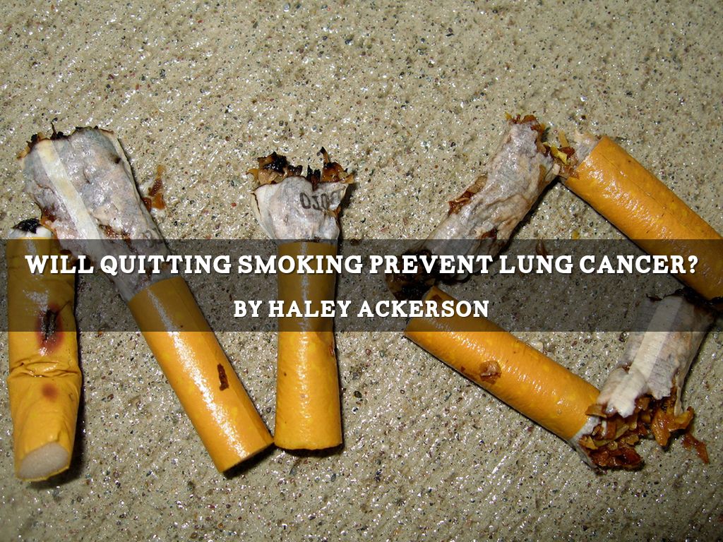 Will Quitting Smoking Prevent Lung Cancer? by Haley