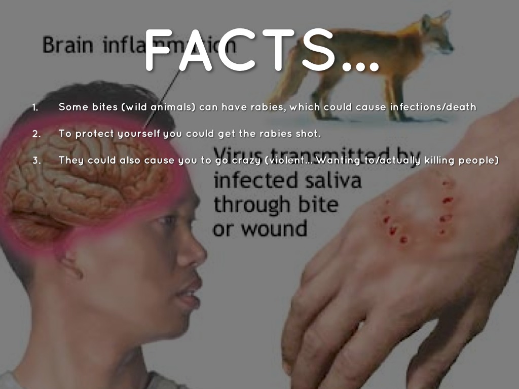 Parenting: Animal Bites by Patty Tabaczynski