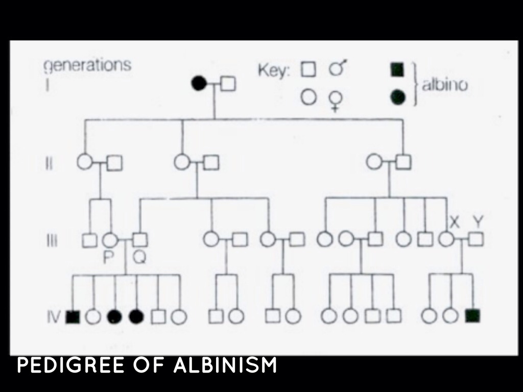 Albinism by Staci Nugent