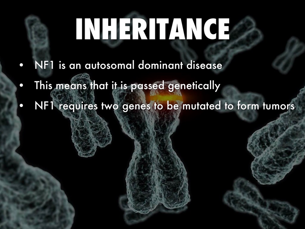 Neurofibromatosis by Ur Mum