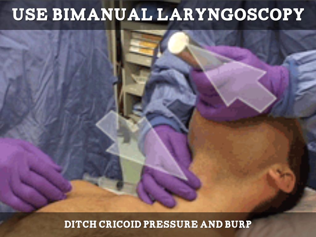 5 Things You Can Do Right Now to Improve Your Intubatio