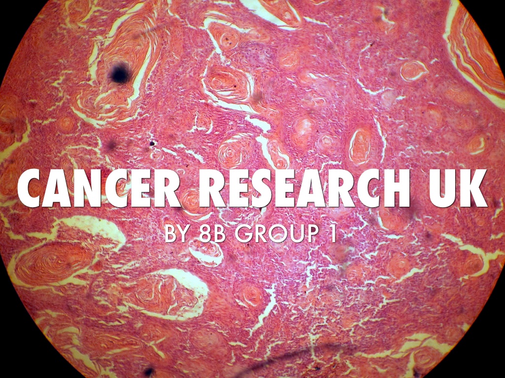 Cancer Reserch U.K by Louis Glenister Homeyard