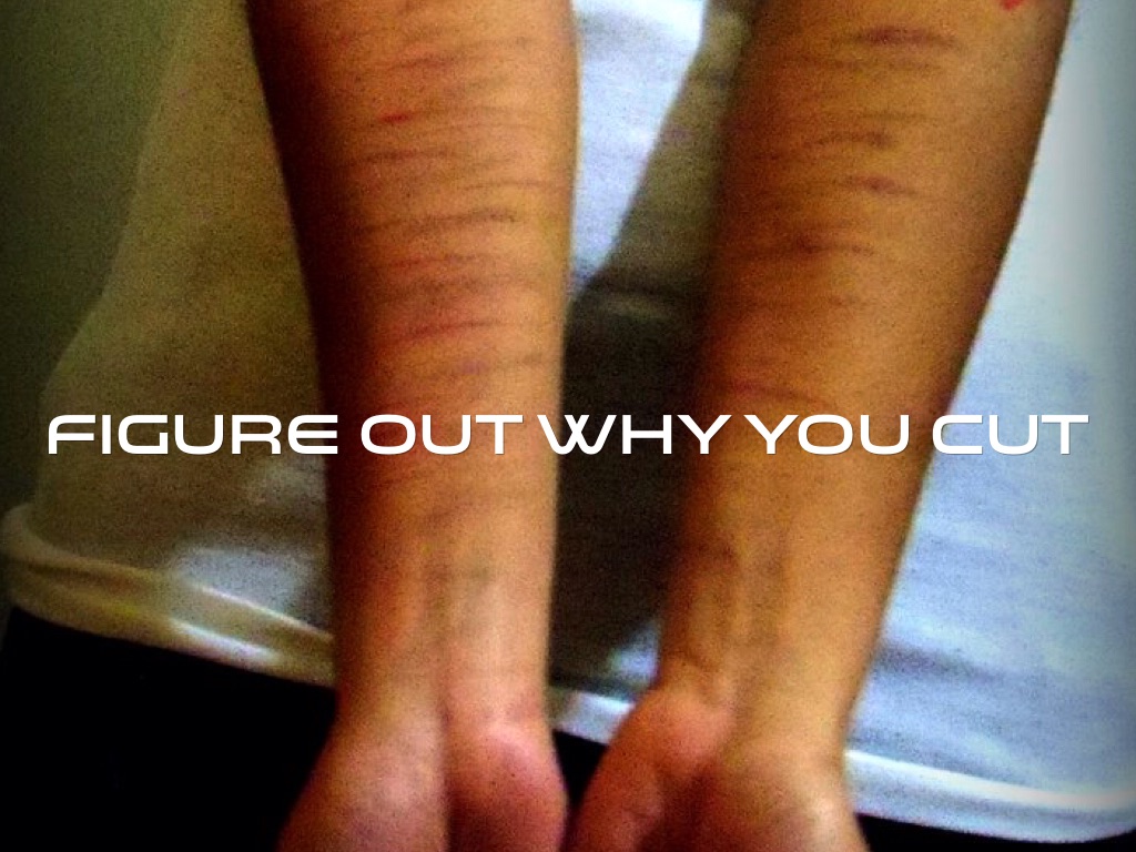 Self-harm by Linda Johnson