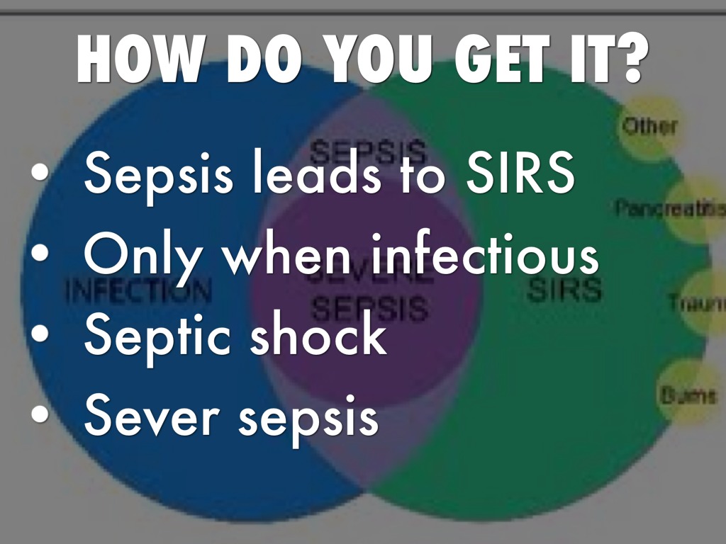 SIRS by Cole Berletch