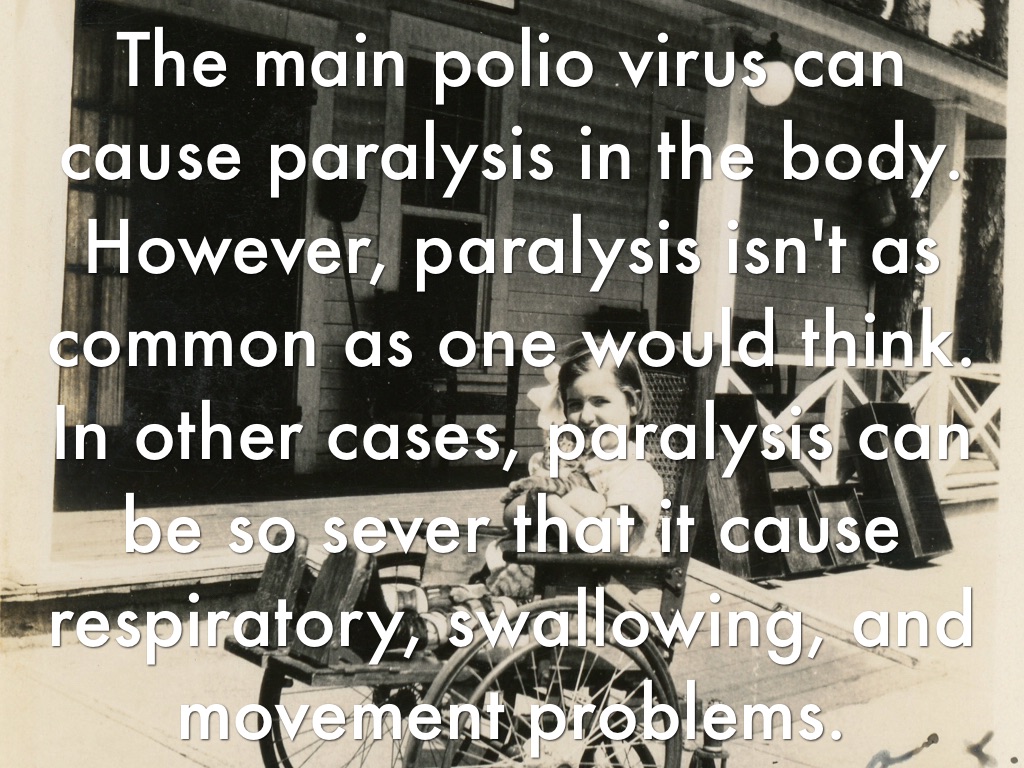Polio by Marcus Laporte