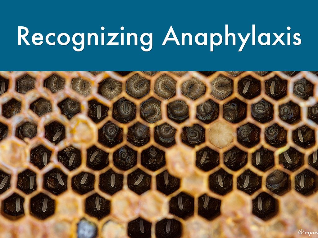 Anaphylaxis by Xi Chu