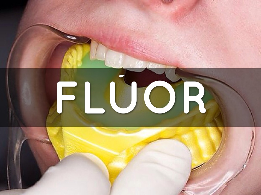 Materiales Dentales Preventivos by María Virginia Muñoz