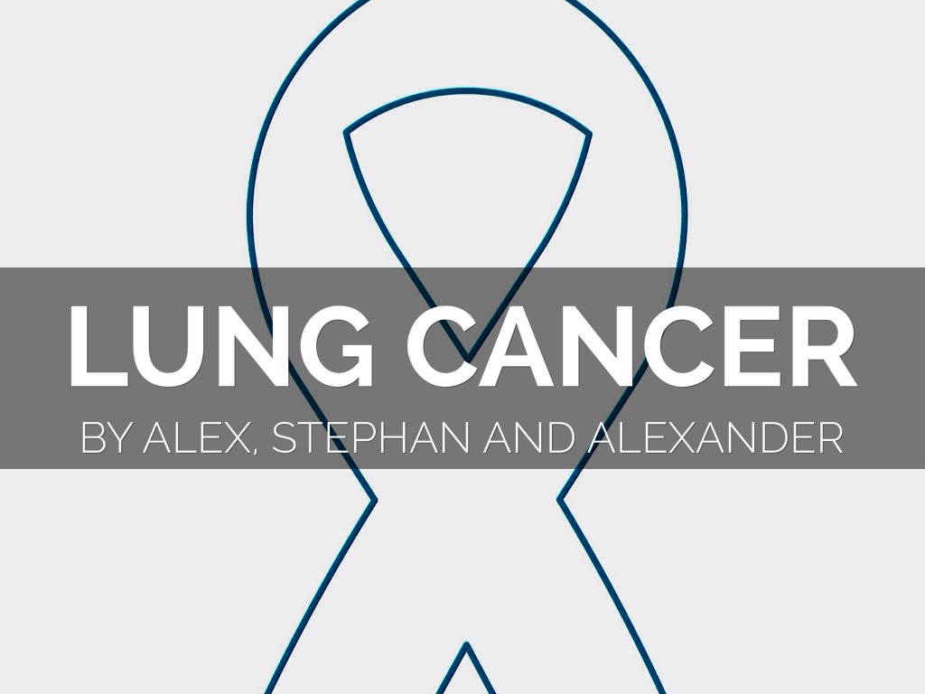 Cancer by Alex Kroeber