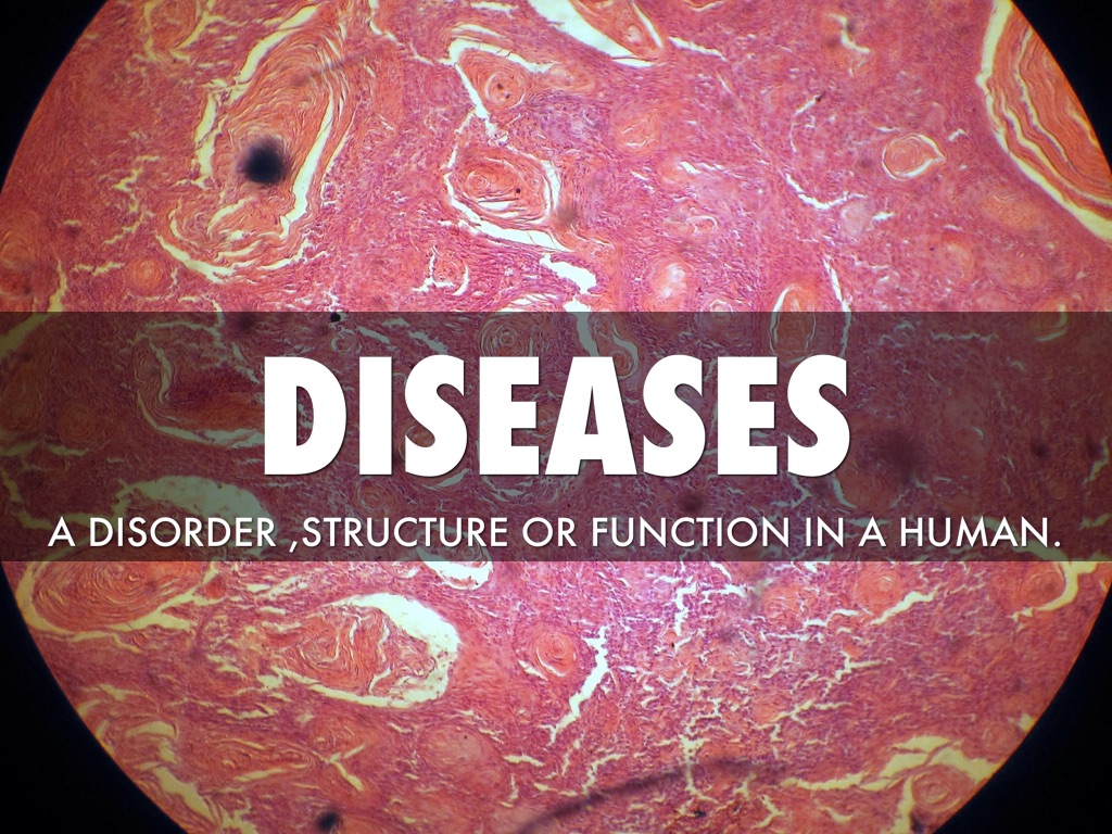 Infectious Vs Noninfectious Disseases by Jose Pimentel-