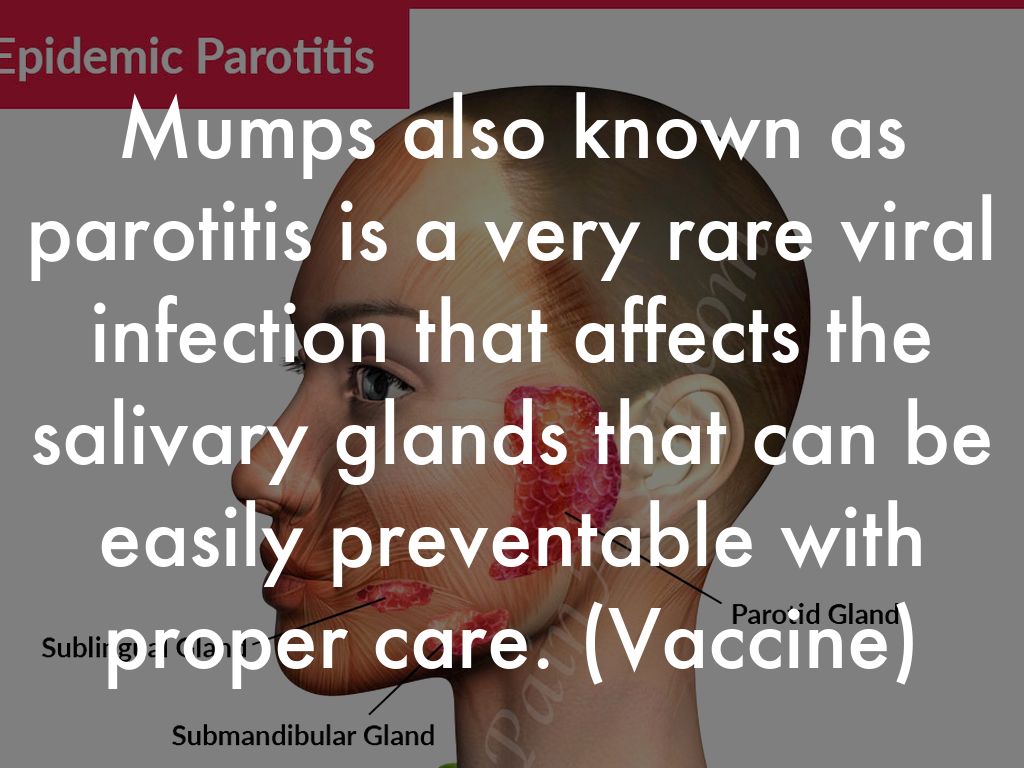 Mumps by Javonni Tarango