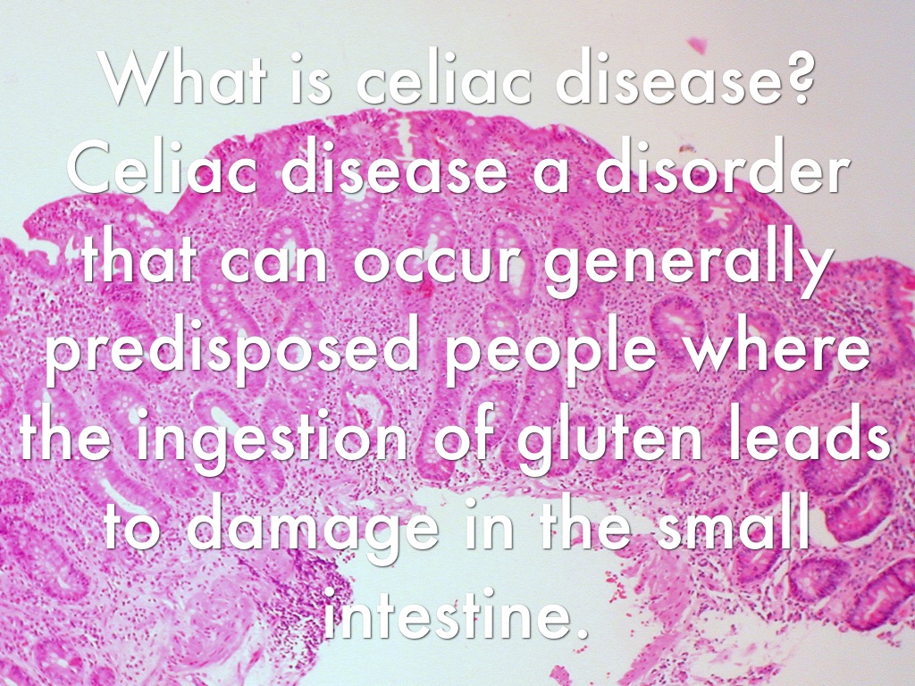 Celiac Disease by liklianamendoza12