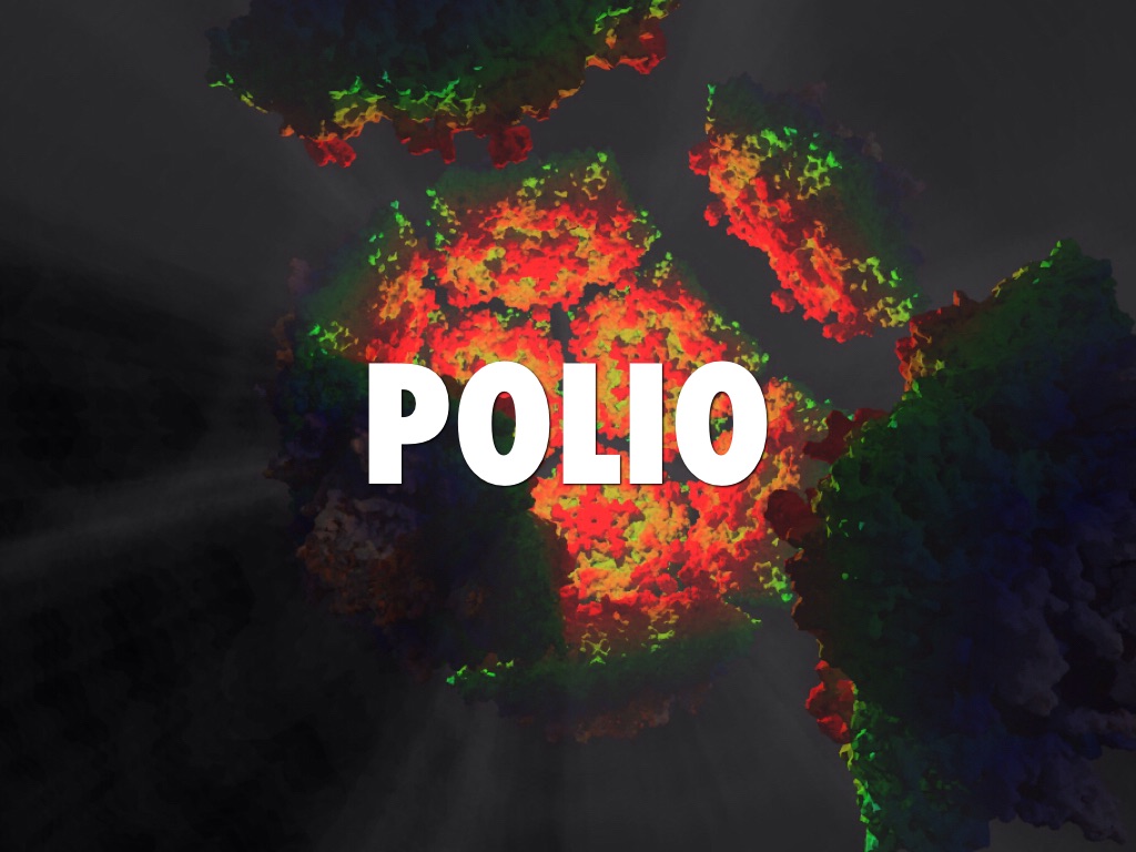 Polio by Marcus Laporte