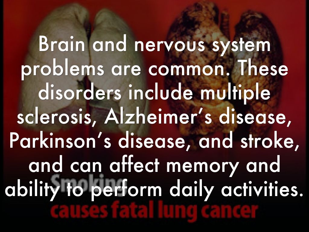 nervous system by shanehughes2323