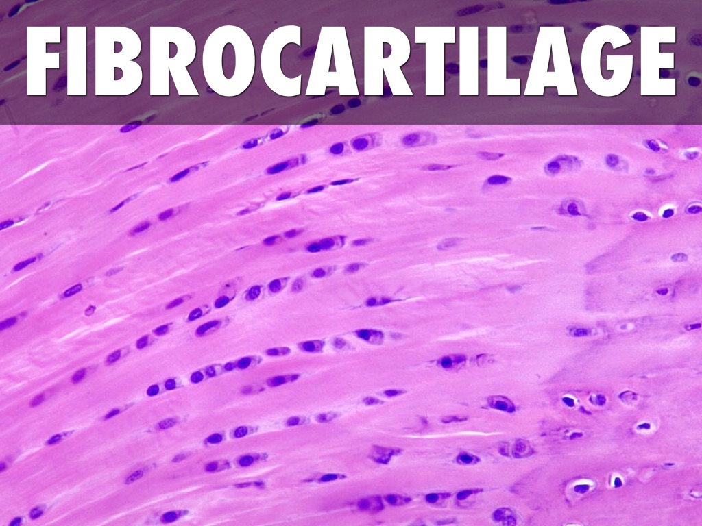 Tissue by Caitlyn Cox