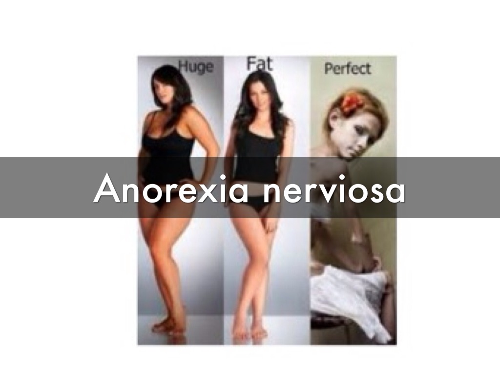 La Bulimia Y Anorexia by Kendy Gonzalez-Salas