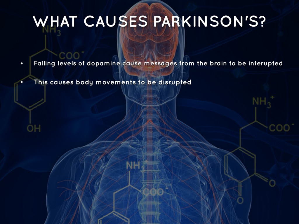 Parkinson's Disease by ariana.b.me2023