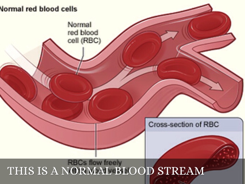 Sickle Disease by Austin Altizer