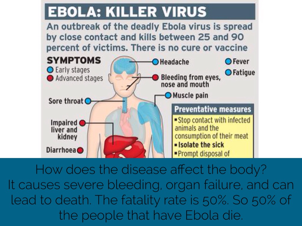 The Ebola Virus by Morgan Schultz