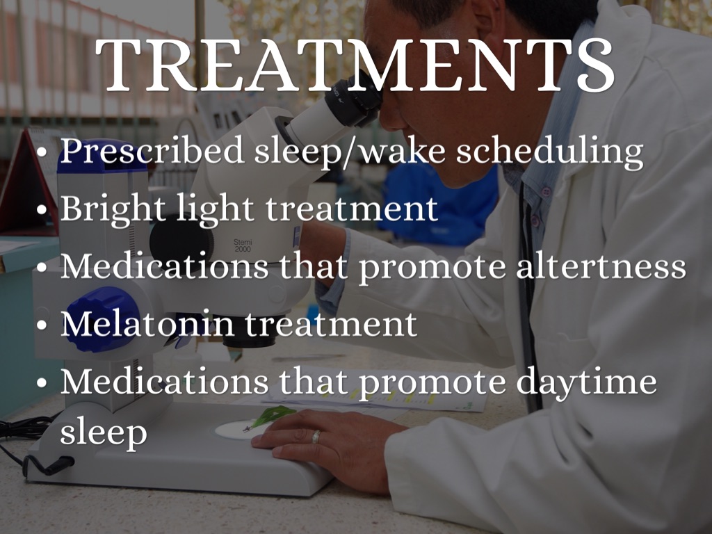 Shift Work Sleep Disorder (SWSD) by Reshay Smith