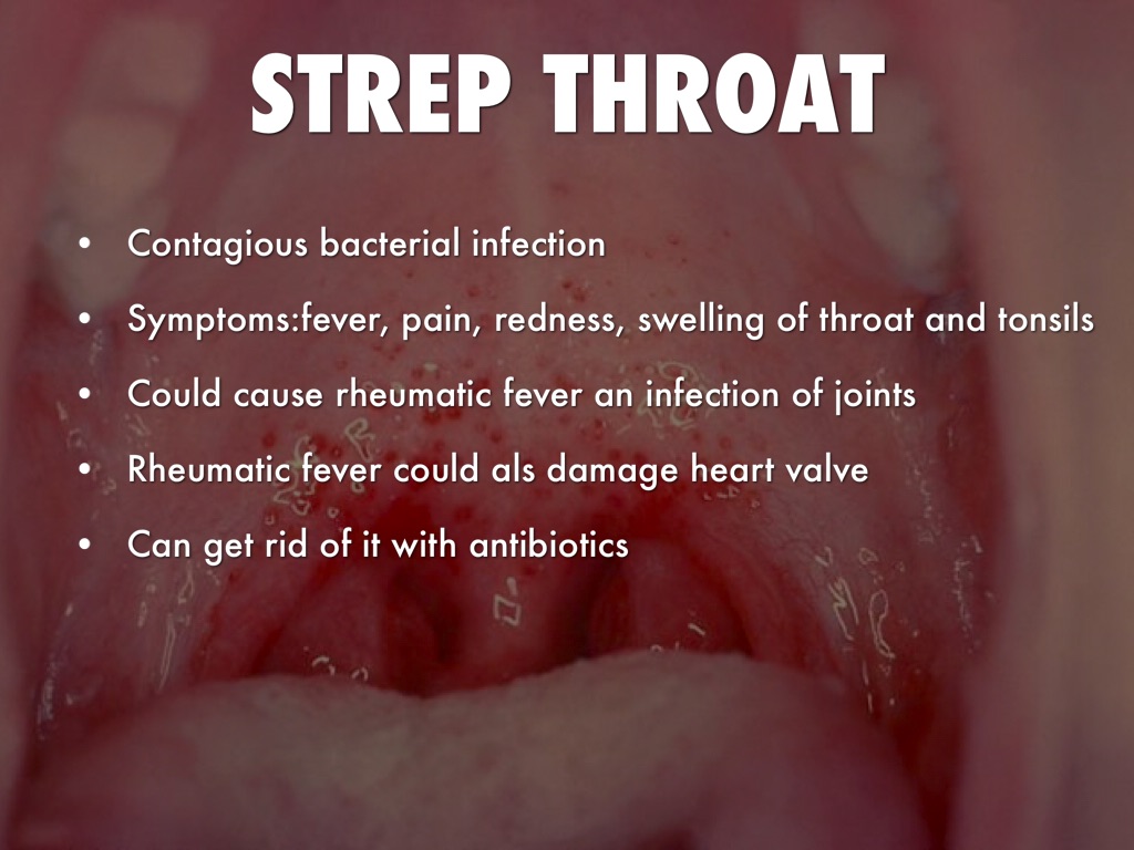 Infectious Diseases By Jacobogomezaristizab