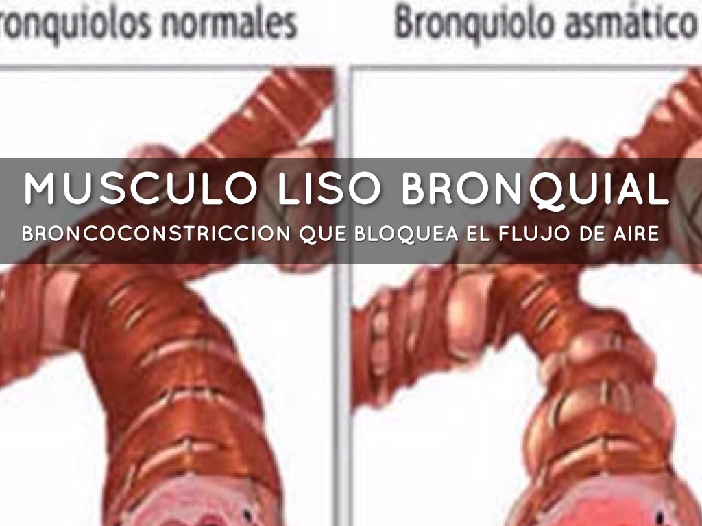 Crisis Asmática by Xochitl Donis