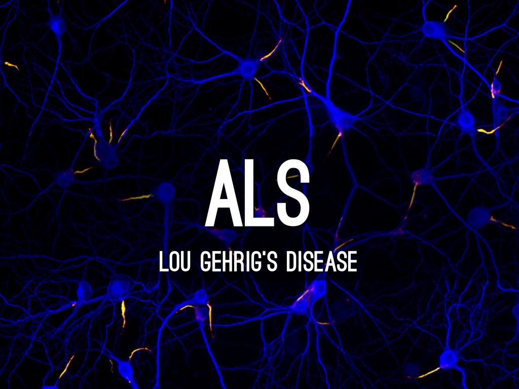 ALS by Hope