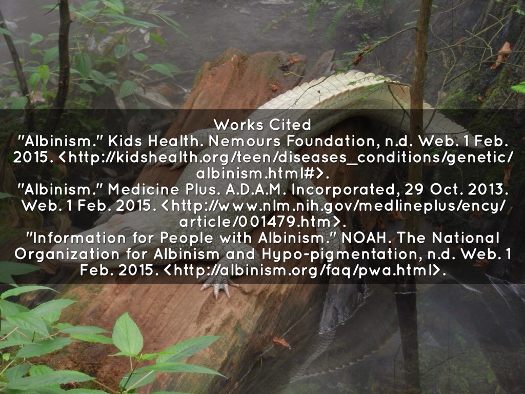 Albinism by Staci Nugent