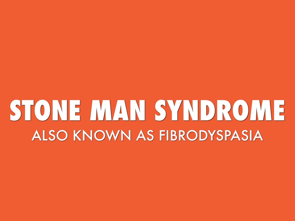 Anatomy Stone Man Syndrome by Cody Griffin