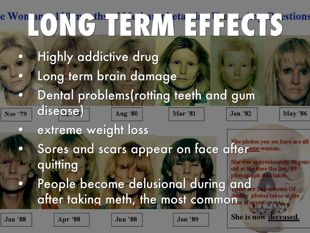 Health Project (Meth) by Lucas Murphy