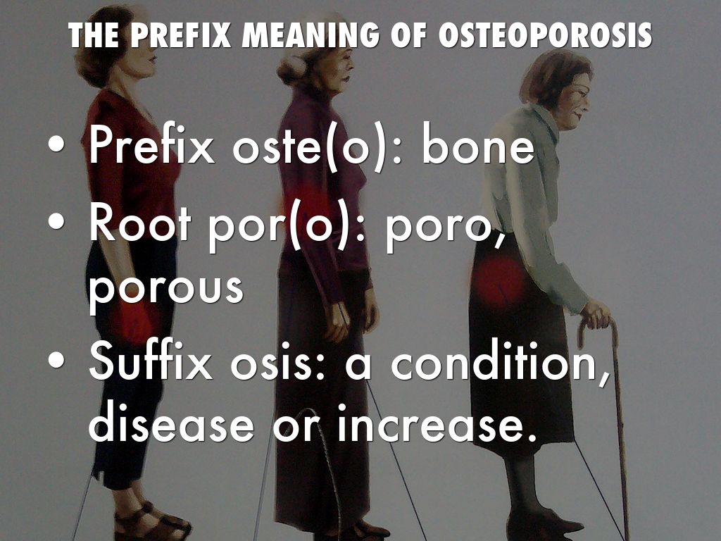 Osteoporosis by Garret Bonello