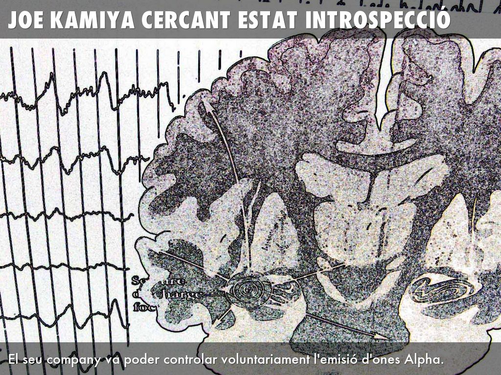 Neurofeedback by ancorixx