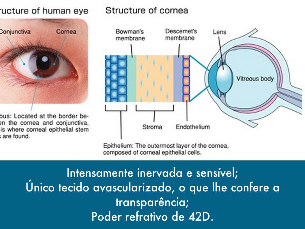 Transplante de Córnea by Sofia Rodrigues