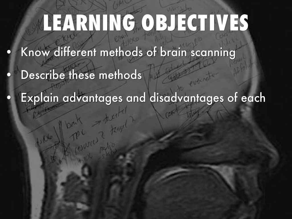 Brain imaging by Helen A
