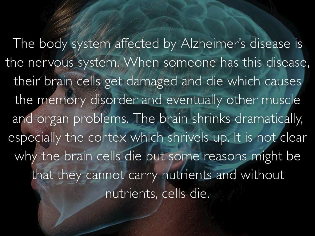 Alzheimers Project by E Ferrigno