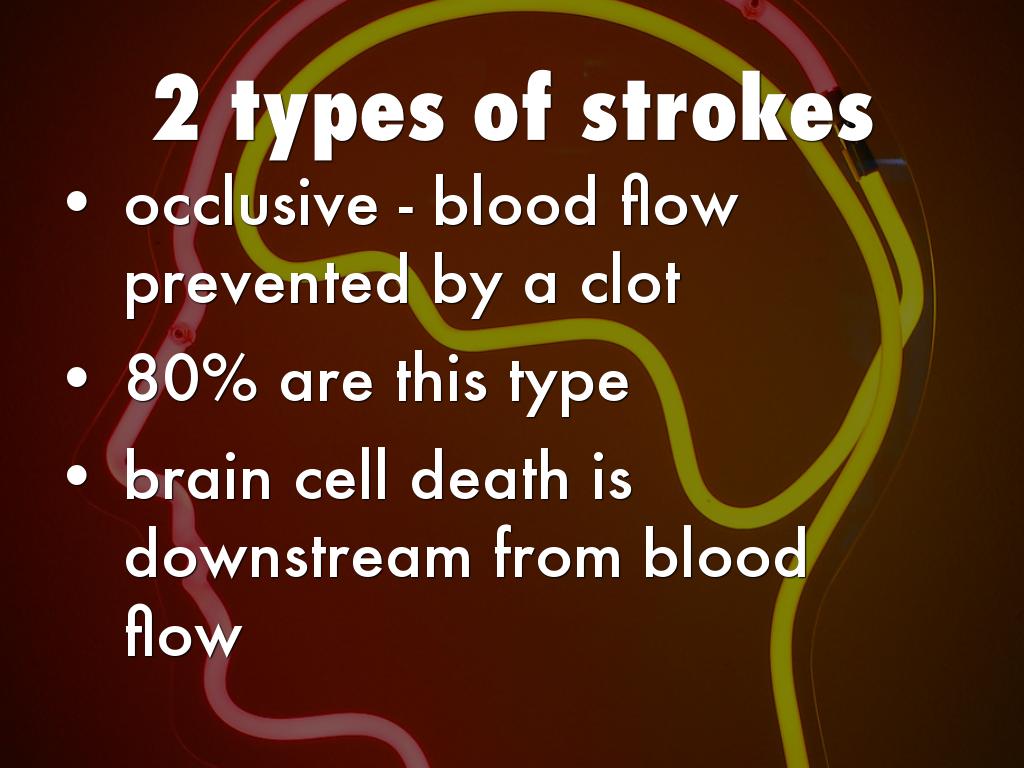 The Science of Stroke by Helen Anderson