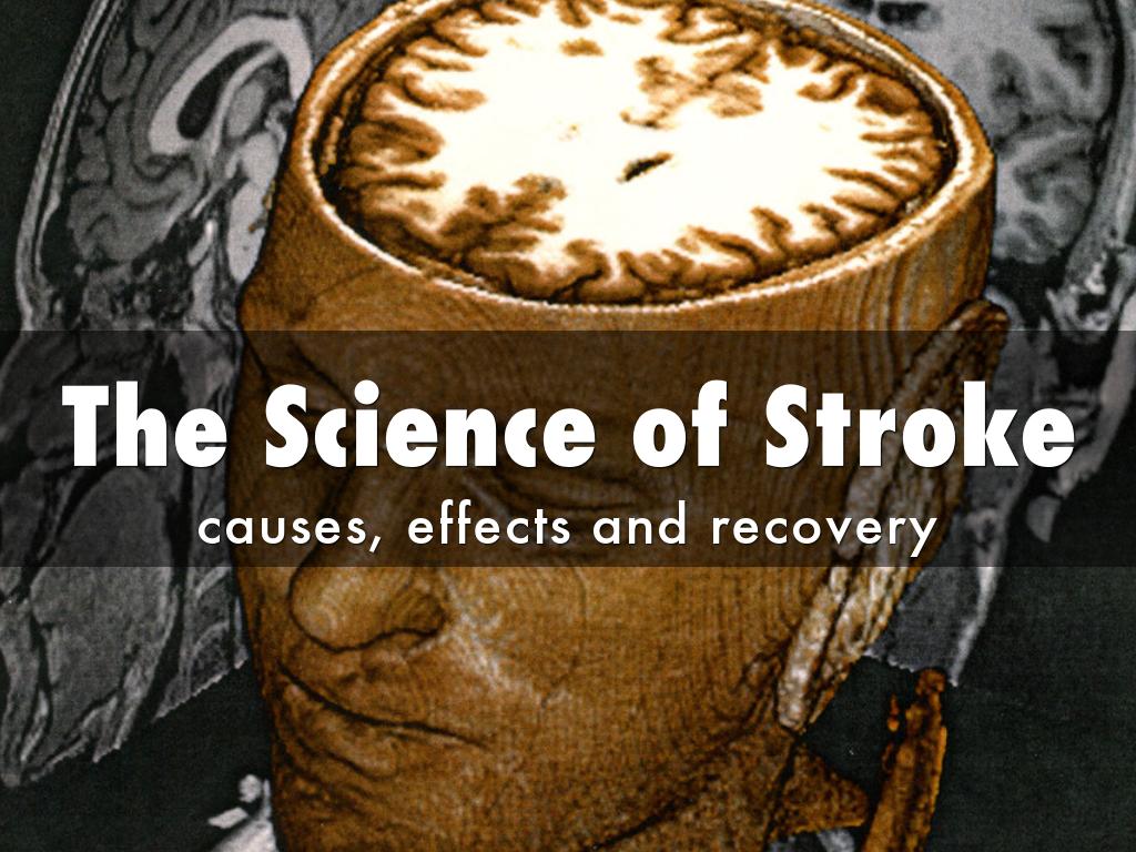 The Science of Stroke by Helen Anderson