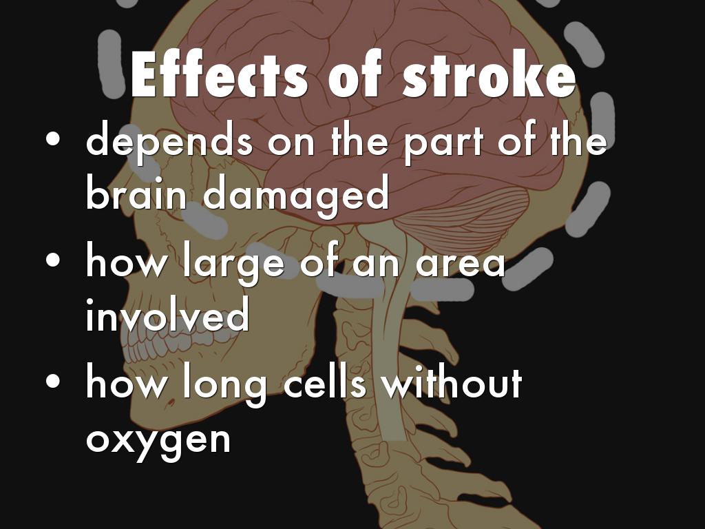The Science of Stroke by Helen Anderson